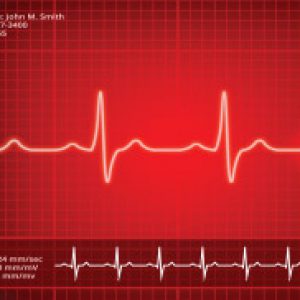 ecg-rood – HeartLife Klinieken