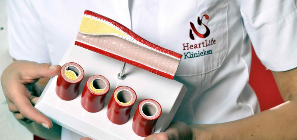 Verwijzen – HeartLife Klinieken